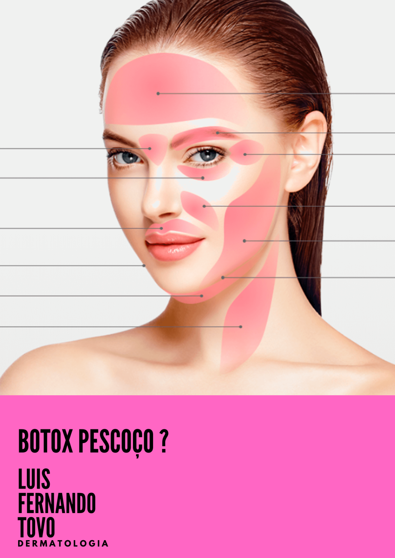 Botox Barbie Trap Tox | botox para afinar o pescoço?